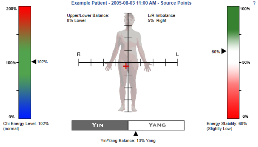What is the AcuGraph? – Acu Essence